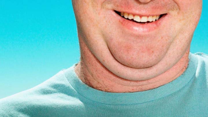 Método sencillo para reducir la papada en 7 días sin tener que hacer ...