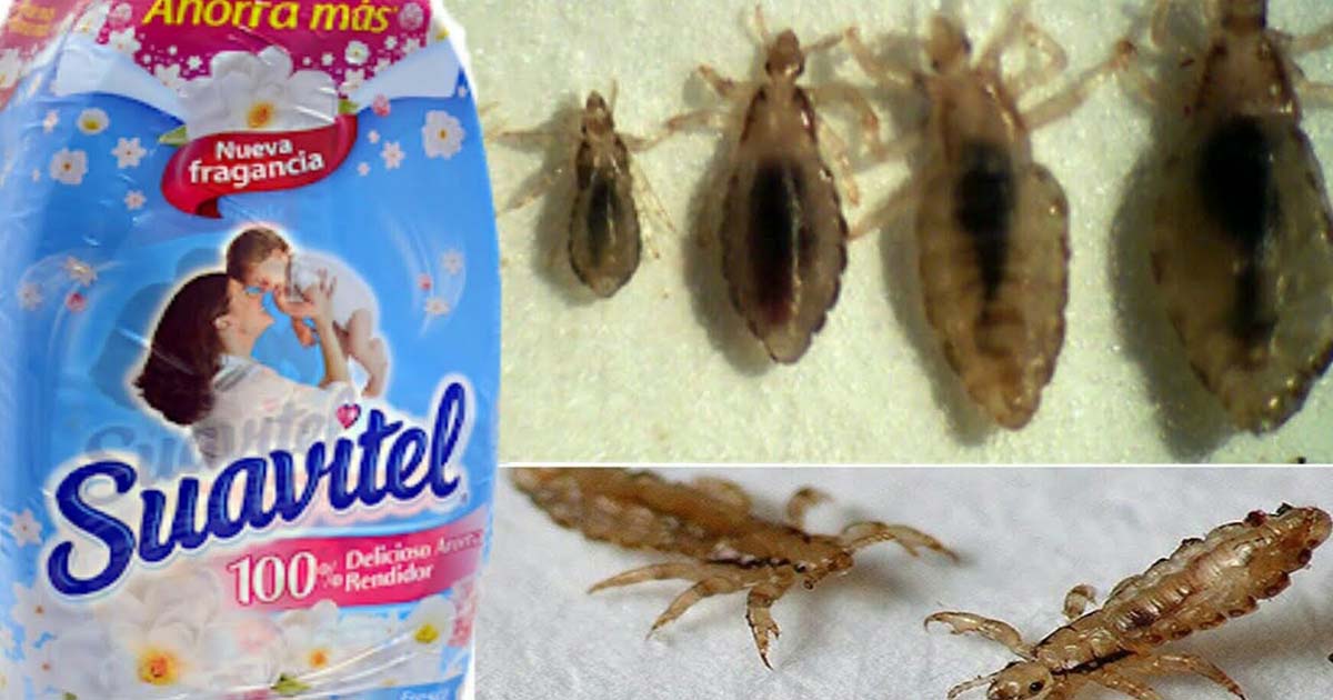 Como quitar piojos y liendres con suavitel - Tuve que verlo